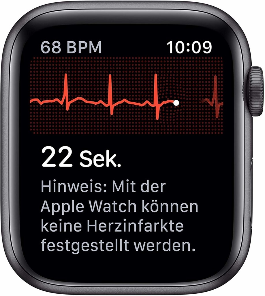 Smartwatch mit EKG Sensor: Apple Watch und die Alternativen